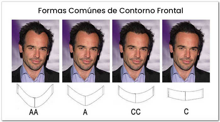 Contorno frontal para prótesis capilares y pelucas de cabello real ...